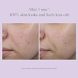 EXUVIANCE Performance Peel AP25 At-Home Chemical Peel with Glycolic, Mandelic and Polyhydroxy Acids, 13 ct.