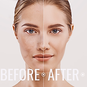 Vitamin C Serum Hyaluronic Acid Anti-aging Face Moisturizer Nourishing Protects your skin Anti-wrinkle care Collagen Glycerin Ascorbic Acid Plumping Cream