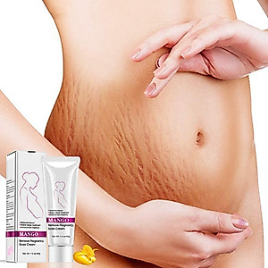 Stretch Mark Cream For Pregnancy Repair Scar Slack Line Abdomen Stretch Marks Cream, Remove Stretch Marks From Pregnancy, Repair Scar Slack Line Abdomen Stretch Marks Postpartum