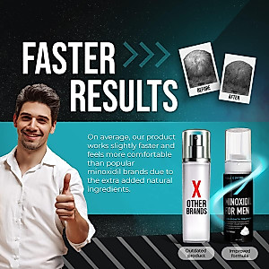 Minoxidil 5% Foam (3 Month Supply) by FolliGuard - Aerosol Foam Hair Regrowth Treatment for Men with Added Biotin and Herbs - Extra Strength for Men