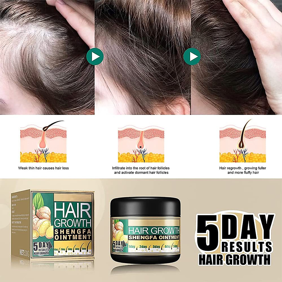 Instagrow Hair Growth Ginger Cream, 30g Ginagen Hair Regrowth Ginger Extract Cream, Natural Hair Growth Ointment, Nourishing Scalp Hair Loss Treatment, for Thinning Hair Men Women (5pcs)