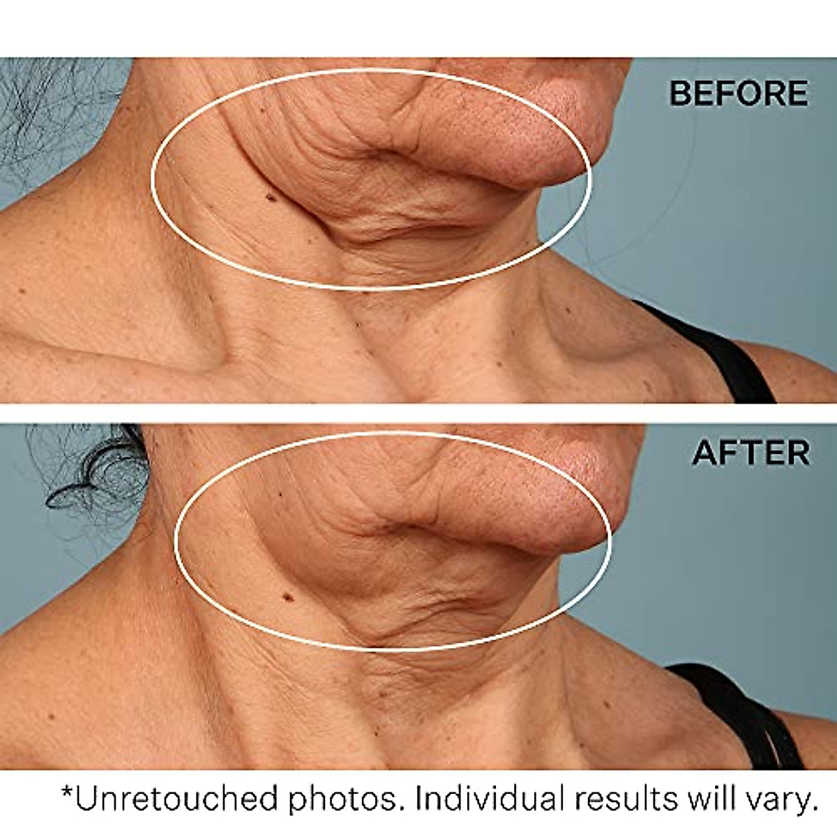 StriVectin Tighten and Lift Advanced Neck Cream PLUS, Anti-Aging Firming and Brightening Complex, 0.25 Fl Oz