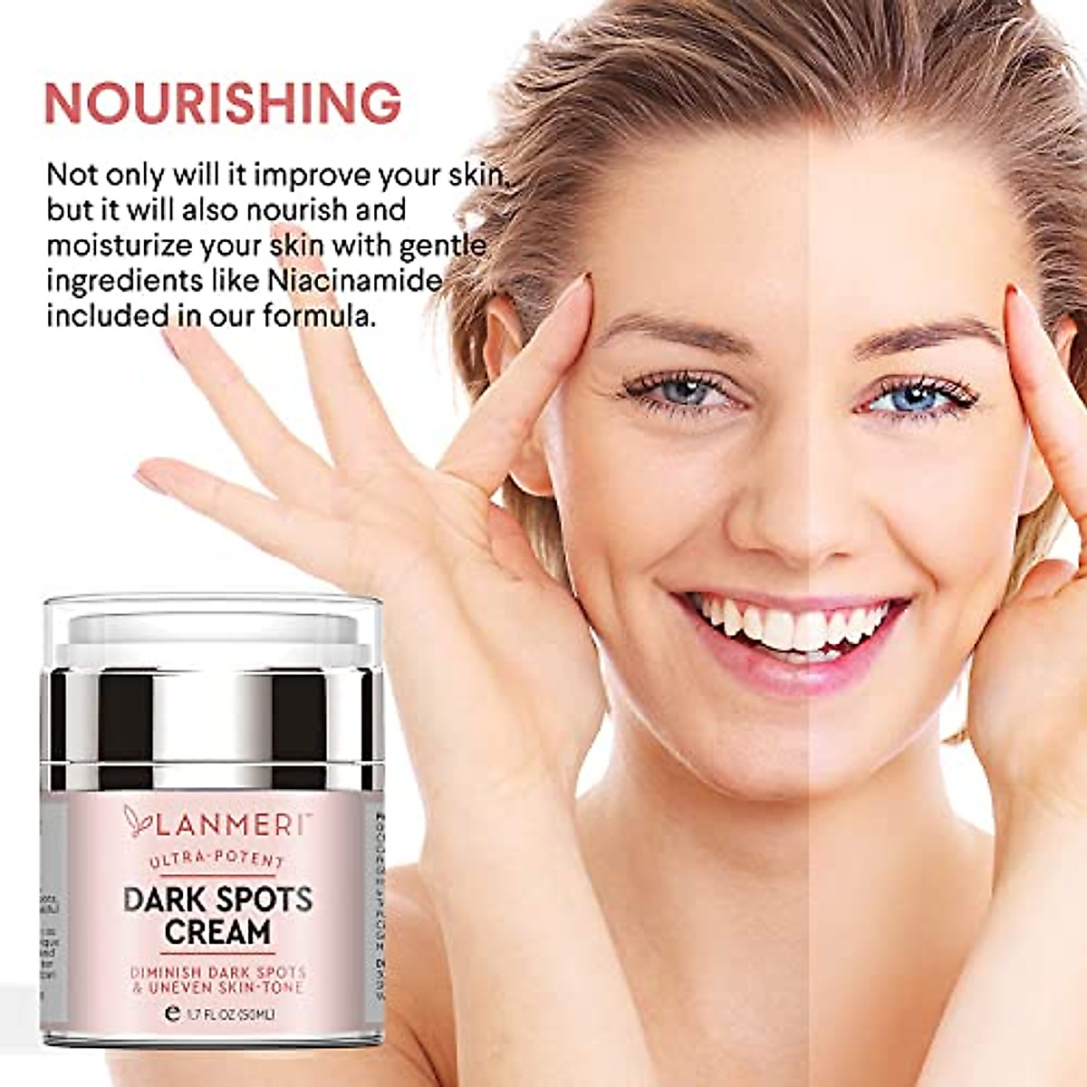 Lanmeri Dark Spot Remover for Face and Body, Dark Spot Corrector Fade Cream, Age Spot, Brown Spot, Sun Spot & Freckle Remover for Face, Hands and Other Body Areas, for Both Women and Men, for All Skin Types