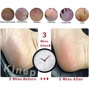 Kinepi Feet Callus Removers Professional Colossal Foot Scrubber Pedicure Foot File Foot Massager Pumice Stone for Feet,Remover Corn Hard Skin Dead Skin Exfoliator for Use in Shower Feet Care Tools
