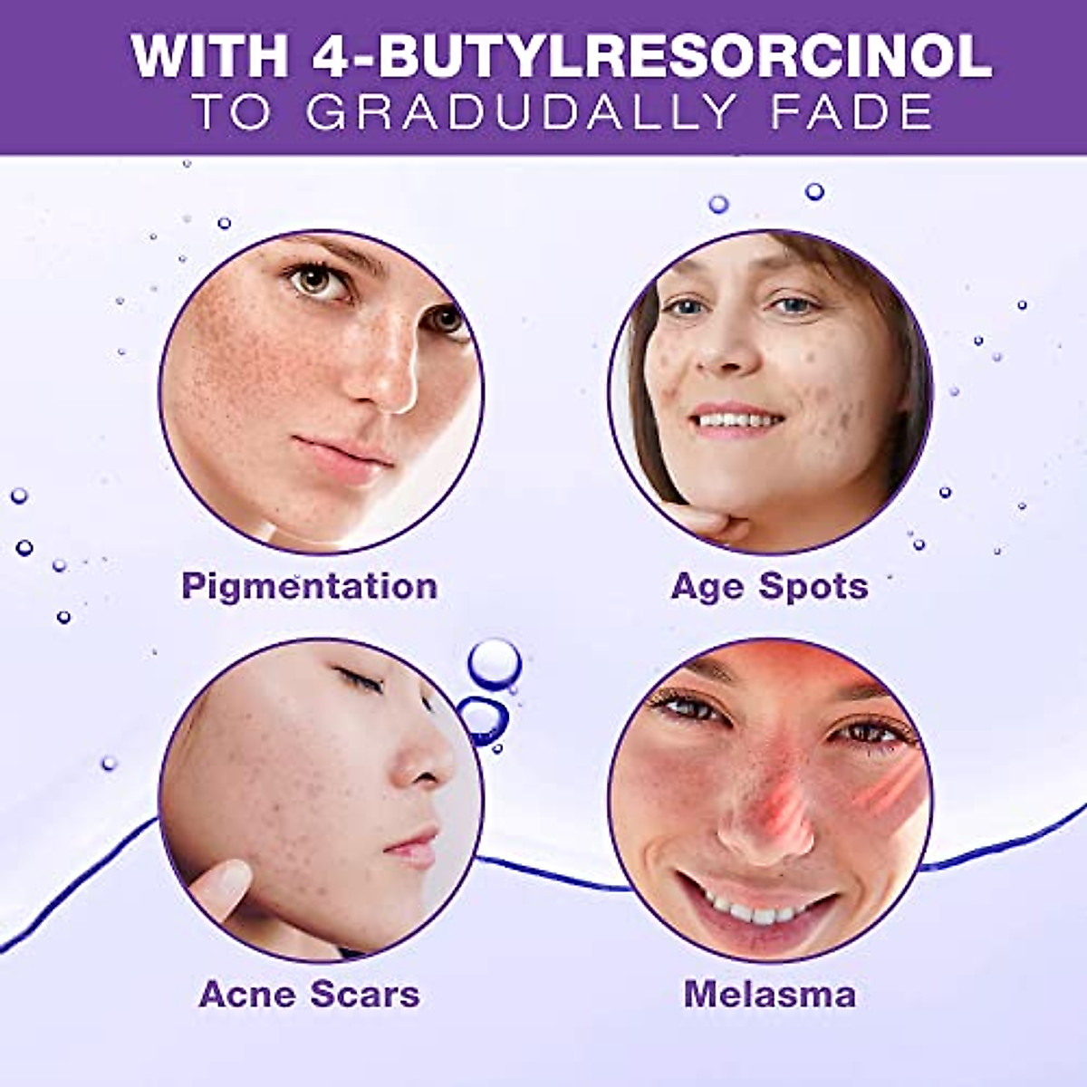 Dark Spot Remover for Face - Dark Spot Corrector Serum for Sun Spot Brown Spots Stubborn Spots-Freckle Remover - Melasma Hyperpigmentation Treatment Formulated with 4-Butylresorcinol, Kojic Acid and Hyaluronic acid- 50 ml