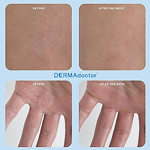 DERMAdoctor Calm Cool + Corrected Clinical Hydra Repair Cream for Face and Body with 1% Colloidal Oatmeal, Moisturizing Skin Repair for Dry, Eczema & Dermatitis Relief + Anti Itch - 6 oz