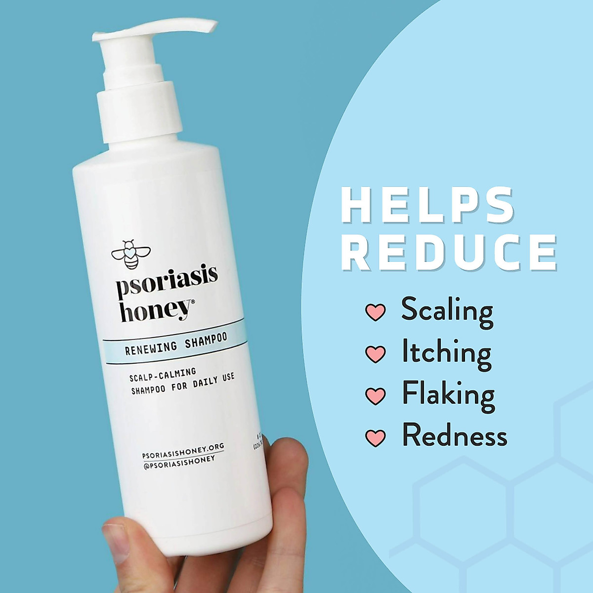 PSORIASIS HONEY Renewing Shampoo - Itchy & Dry Scalp Treatment - Psoriasis Shampoo With Argan Oil for Women & Men - Scalp Psoriasis Relief - Daily Hair Shampoo for Kids (8oz)