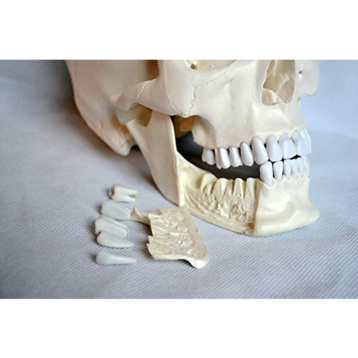 Wellden Medical Anatomical Skull Model, 4-Part, with Lower Jaw 16 Teeth Extractable