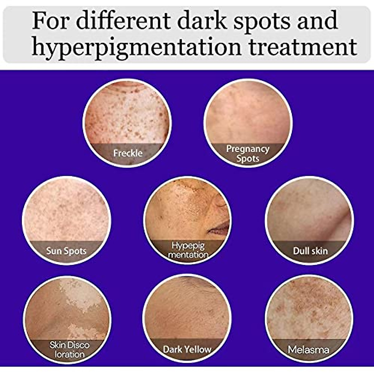 Inlifay Dark Spot Remover for Face Hyperpigmentation Treatment. Dark Spots, Melasma, Freckle, Sun Spots Removal Dark Spot Corrector Cream for Women and Men