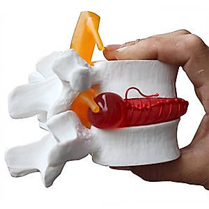 BoNew-Oral 1:1.5 Anatomical Human Lumbar Vertebrae Degenerative Lumbar Human Spine Model White Color