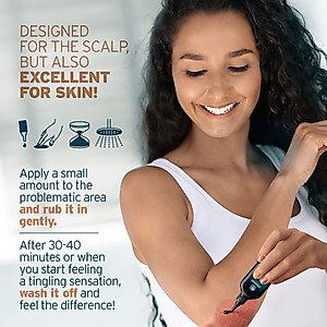 Severe Flaky Psoriasis Natural Serum and Shampoo 13.5 fl oz with Salicylic Acid Set