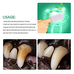 HEEPDD 20Pcs Dog Dental Wipes, Dog Teeth Cleaning Finger Wipes for Dogs Cats, Freshen Breath, Reduce Plaque Tartar, No Brushing