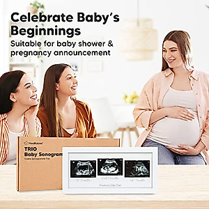 Sonogram Picture Frame - Trio Ultrasound Picture Frames For Mom To Be Gift - Baby Ultrasound frame - Pregnancy Announcements Sonogram frame - Baby Nursery Decor, Pregnant Mom Gifts (Alpine White)