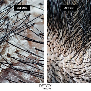 YBERA PARIS Professional Detox Healthy DUO | Refreshing Care for Oily | Prevent Hair Loss | Stimulate Growth & Improve Damaged Hair | Shampoo 8.4 Oz & Conditioner 8.8 Oz