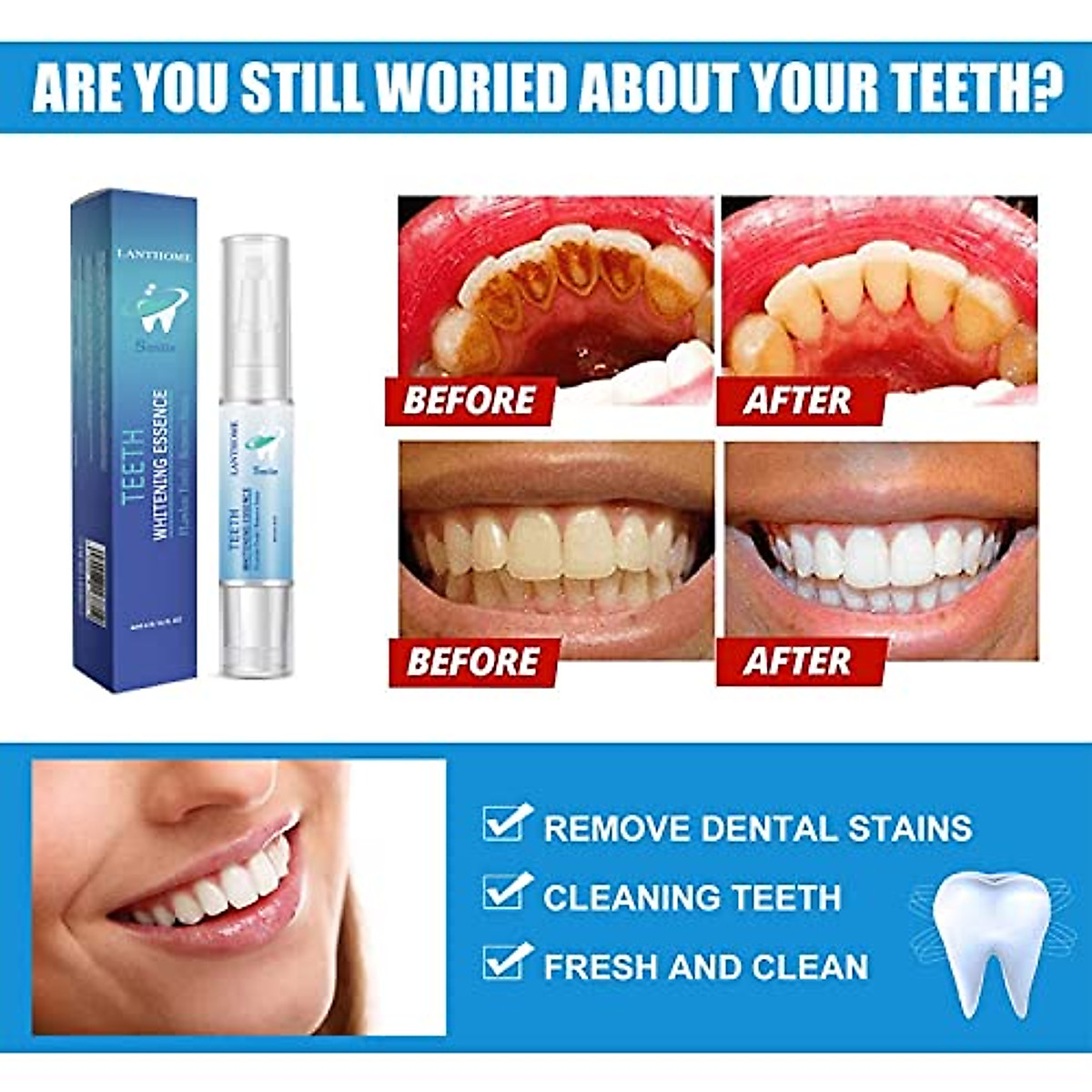 LANTHOME Teeth Whitening Pen - Teeth Whitening Essence Pen, Herbaluxy Teeth Whitening Gel, Travel Tooth Whitening Pen, Beautiful White Smile (3pcs)