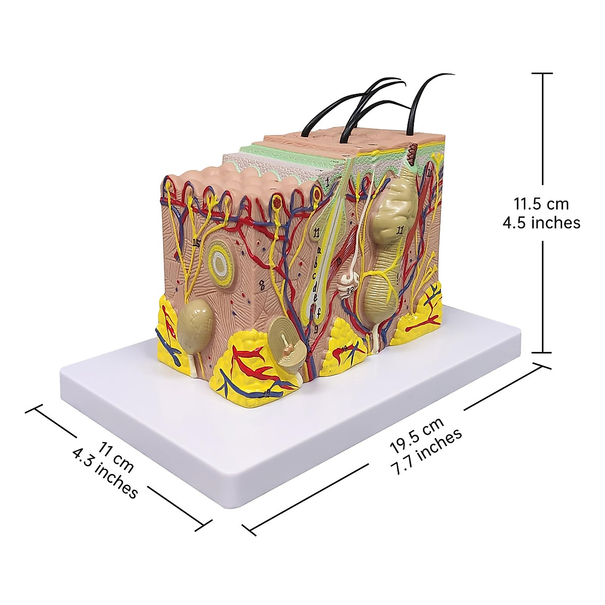 Ultrassist Skin Anatomy Model with A Study Guide, 35 Times Enlarged Anatomical Skin Model, Teaching Tool for Science Study or Patient Education