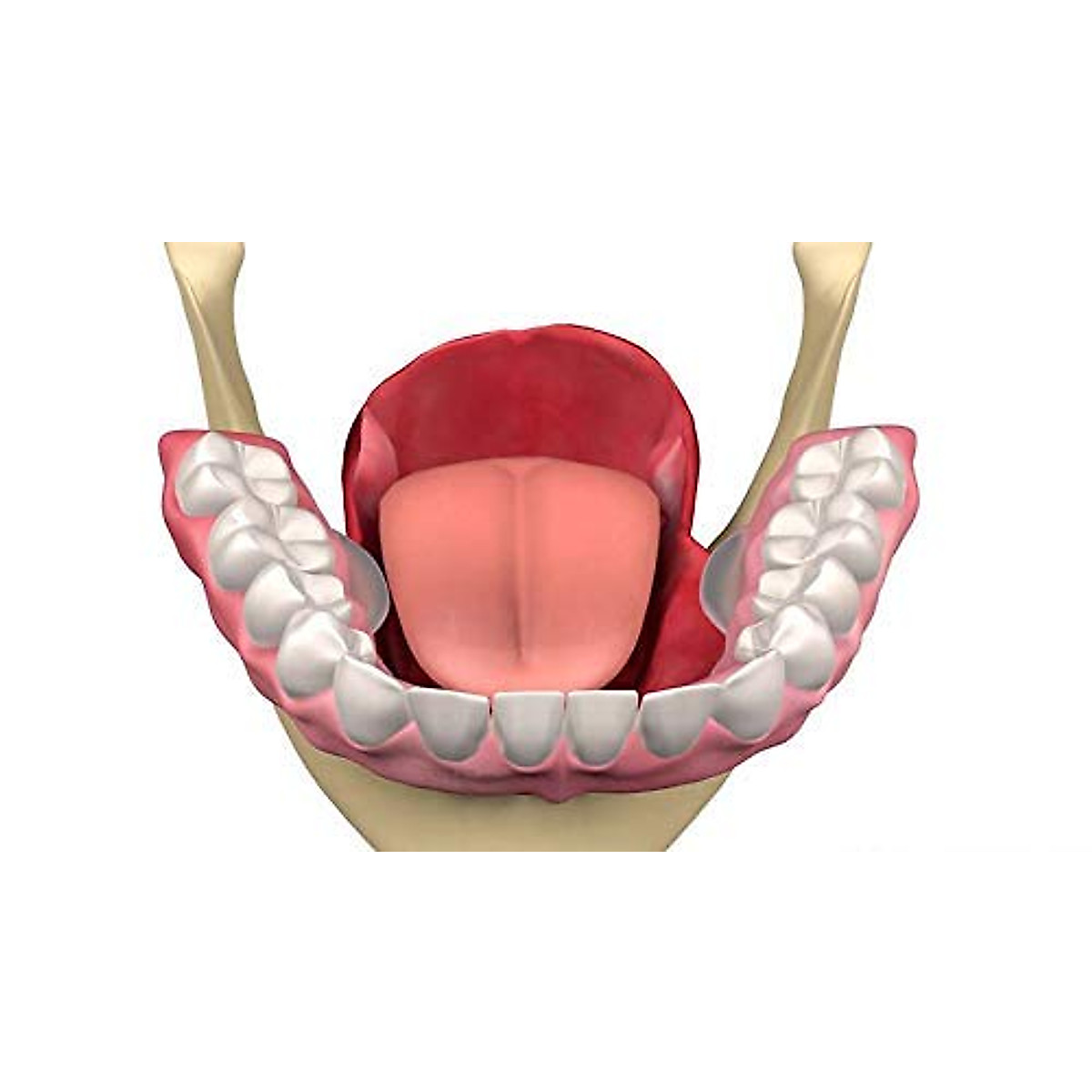 Lower Denture Stabilizers