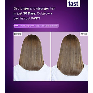 Nisim F.A.S.T. Fortified Amino Scalp Therapy Shampoo, 10 fl oz - Supports Faster Hair Growth with Essential Nutrients, Amino Acids & Proteins - Sulfate, Paraben-free