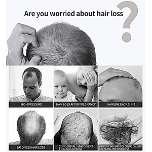 DISAAR Beauty Growth Hair Oil Spray Repair Follicles Strengthen Hair Root DHT Blocker Nourishing 30ml / 1.01fl.oz