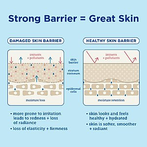 Skinfix Eczema+ Dermatitis Face Balm: Target Facial Dermatitis, Eczema & Dry Skin Patches, Concentrated Balm That Leaves Irritated Skin Soothed & Protected, 0.48 Fl Oz