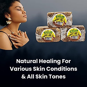 Infinix Shea Butter Face & Body Soap Bar for Oily Skin - 100% Natural African Black Soap with Pure Honey - Removes Dark Spots - Cleanses and Nourishes Skin