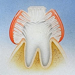 SDFSDFSF Three Side Toothbrush is Used for Tooth Protection, Powerful Cleaning, Removing Tooth Stains, Smoke Stains, Tooth Stones, Three Side Adult Hand Soft Hair (Yellow)