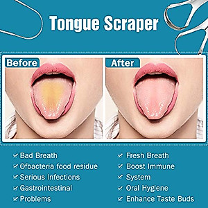 YLYL 3 PCS Metal Tongue Scraper, Tongue Scrapers for Adults Kids, Stainless Steel Tounge Scrappers, Tounge Scraper Cleaner, Portable Tongue Cleaner