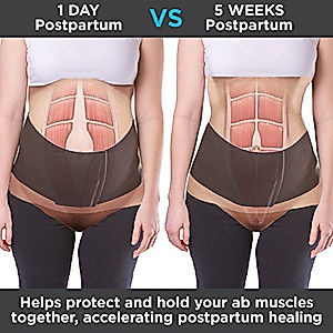 BraceAbility Abdominal Treatment Wrap for Diastasis Recti | Breathable, Non-Slip Postpartum Tummy Slimming Band for Stomach Muscle Support, Back & Waist Compression After Pregnancy (XS)