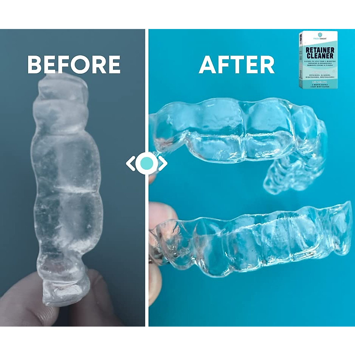 Retainer Cleaner, Denture Cleaner (120 Tablets) Removes Cloudiness, Brightens and Freshens Clear Aligners, Retainers, Night Guards, Mouth Guards, Dental Appliances, Fresh Knight