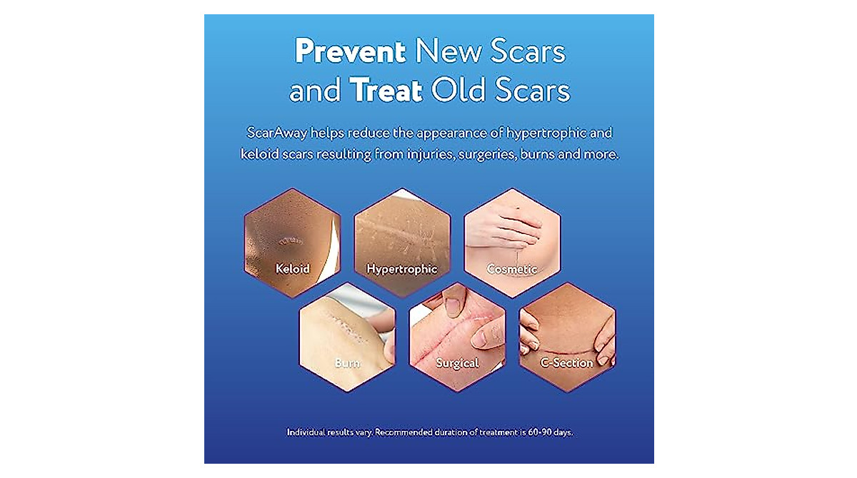 ScarAway Silicone Gel - Improve Scars Fast