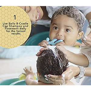BELLA B Cradle Cap Shampoo & Cradle Cap Scalp Treatment And Conditioner - Baby Shampoo And Conditioner - Cradle Cap Shampoo For Babies - Kid Shampoo - Dry Scalp Shampoo And Conditioner For Dry Scalp