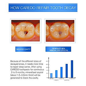 CAREDO Cavity Repair Toothpaste Set for Adults, 16g Pulpitis Ointment for Tooth Decay Pain Repair & 100g Hydroxyapatite Toothpaste for Home Cavity Repair, Cavity Tooth Repair Fluoride Free Toothpaste