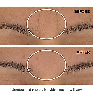 StriVectin Advanced Retinol Star Light Night Oil with Squalane, Improves Skin Texture, Wrinkles, Firmness and Dehydration, 1 Fl Oz (Pack of 1)