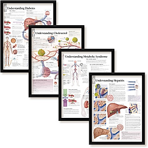 Set of 4 Framed Medical Posters Understanding Diabetes Understanding Cholesterol Understanding Metabolic Syndrome and Understanding Hepatitis 22"x28" Wall Diagrams