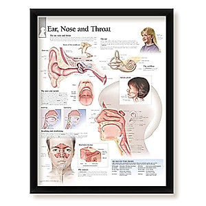 Set of 4 Framed Medical Posters Ear, Nose and Throat, Understanding Sinusitis, Understanding Rhinitis, and Middle Ear Infections 22"x28" Wall Diagrams