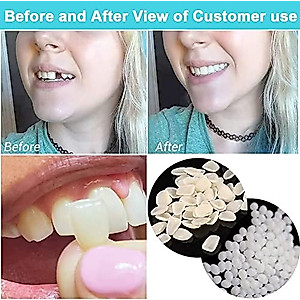 Tempoary Tooth Repair Kits DIY Dental Care Kit Glue for Filling Missing Broken Teeth Crowns and Bridges Moldable Fake Teeth to Regain Your Beautiful Smile in Minutes-White Color