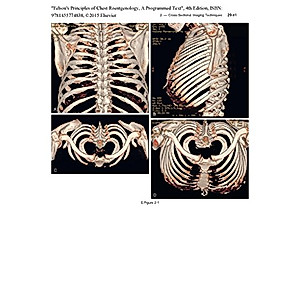 Felson's Principles of Chest Roentgenology, A Programmed Text (Goodman, Felson's Principles of Chest Roentgenology)