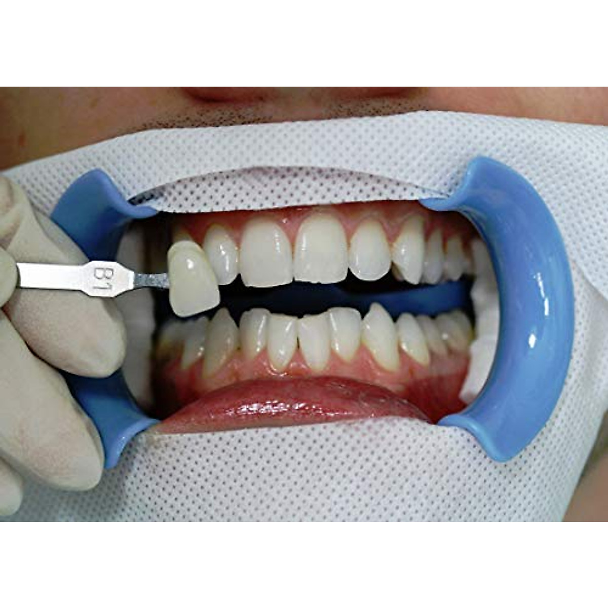 BEYOND FLEXIBLUE Comfort Cheek Retractors | Disposable Dental Cheek Retractors | Plastic Mouth Opener - Medium 10pk