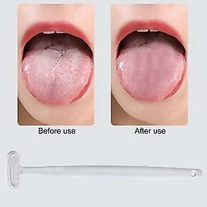 YOXIER Tongue Brush Useful Durable Tongue Cleaner ABS Good Plasticity Grey