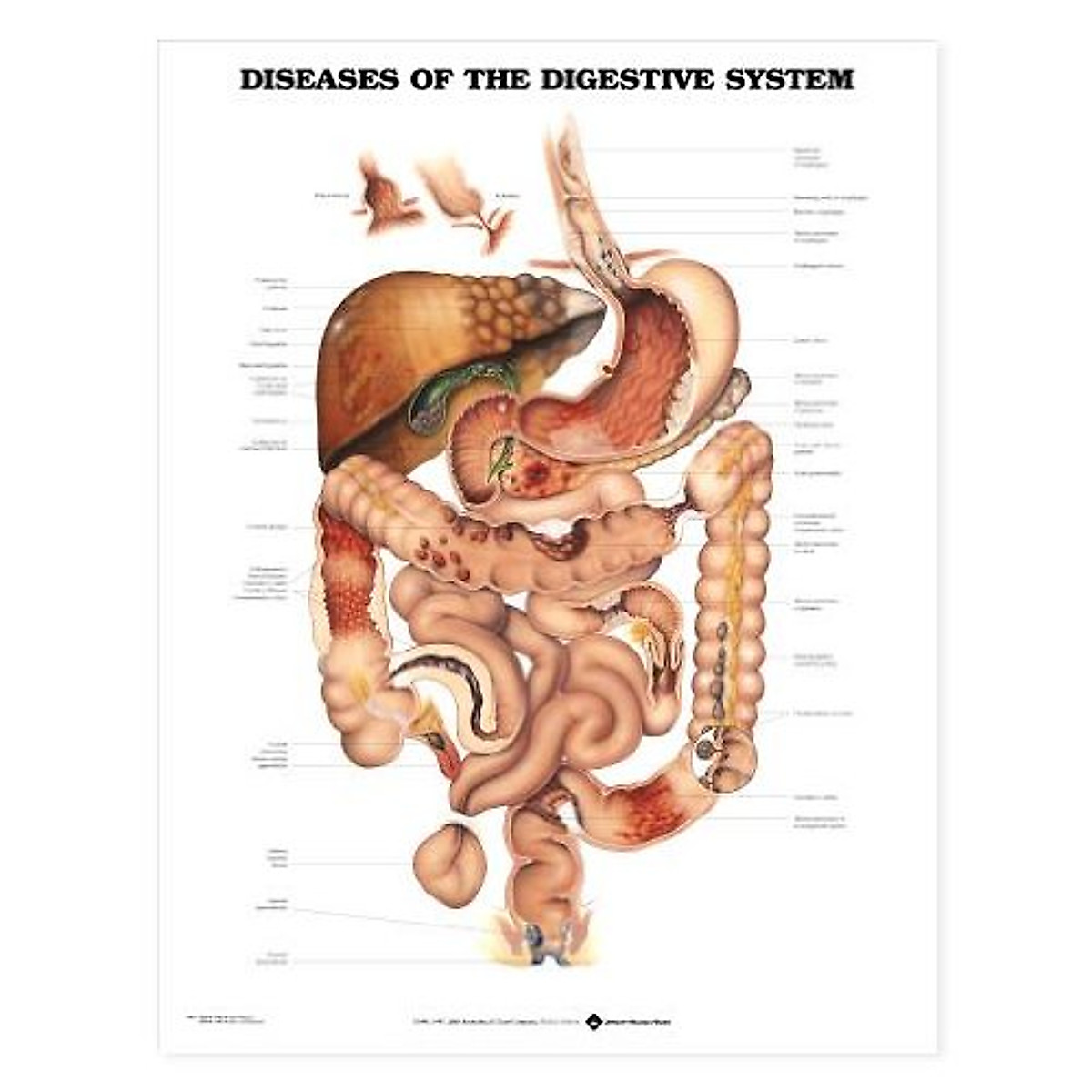 Diseases of the Digestive System Chart