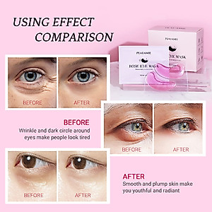 PEAUAMIE Under Eye Patchs Rose Eye Mask for Dark Circles and Puffiness Wrinkle Eye Bags 30 Pairs
