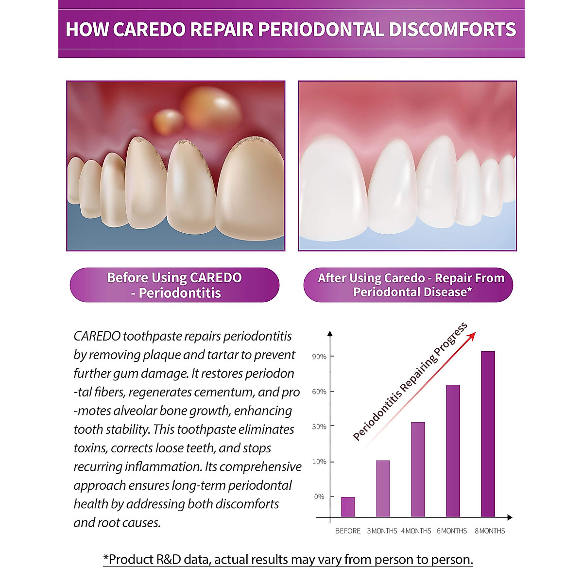 Medicine Toothpaste Healing Early-Mid Periodontitis Treatment at Home, Gum Repair for Receding Gums, Gum Disease & Gingivitis Treatment, Periodontal Disease Treatment Hydroxyapatite Toothpaste, 3.52OZ