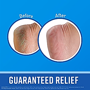O'Keeffe's for Healthy Feet Foot Cream, Guaranteed Relief for Extremely Dry, Cracked Feet, Instantly Boosts Moisture Levels, 3.2 Ounce Jar, (Pack of 1)