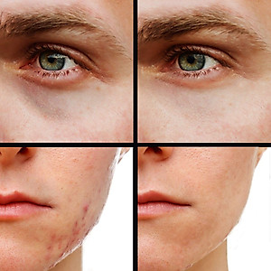 KODE Mens Concealer (Shade 3 of 6) Dark Circle Under Eye Cream Corrector, Multi-Use, Pimples, Scars, Rashes