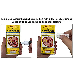 R-CAT for Arrhythmias EKG Pocket Reference Guide – Great Study Card for EKG Interpretation - ACLS and PALS Training – Cardiac Rhythm Interpretation Made Easy