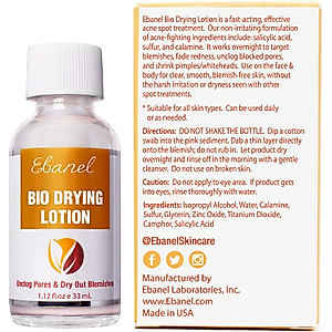Ebanel Acne Drying Lotion, Overnight Salicylic Acid and Sulfur Cystic Acne Spot Treatment for Face and Body, Pimple Cream Spot Treatment, Dries Out Pimples, Cysts, Blemishes, Zits, and Clogged Pores