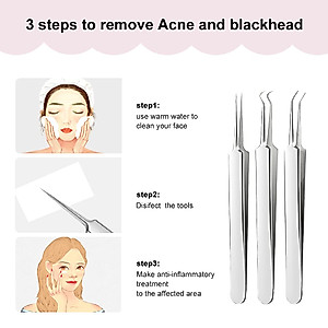 La Chat Blackhead Remover Kit - Blackhead Tweezers Removal Tool 3 pcs Comedone Pimple Extractor Tool, Acne Blemish Kit for Blackhead, pimple Tool, Curved Blackhead Tweezers kit (3 pcs)