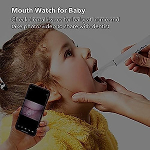 visclyn Smart Dental Floss| Viewable Oral Check and Teeth Floss for Baby and Family | Screenshot and Video Record for Sharing via App - Blue