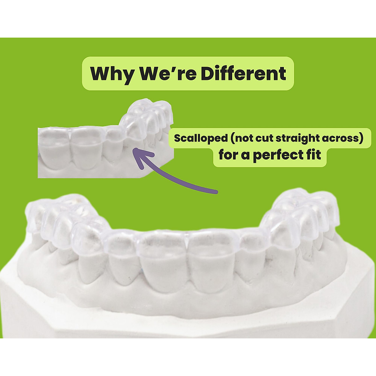 SENTINEL MOUTHGUARDS Durability Mouth Guard for Heavy Teeth Grinding and Jaw Clenching | Comfortable and Custom Fit | Dentist-Grade Material | Long-Lasting Protection | BPA-Free