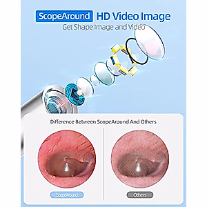 Digital Otoscope with Light, Ear Camera with Ear Wax Removal Tool, ScopeAround Ear Cleaning Camera with 5" Screen for Kids, Adults & Pets, Ear Scope, 32GB Card Supports Photo and Video Recording.